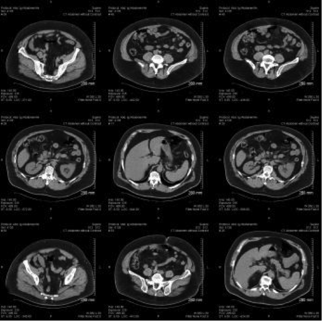 Tomodensitométrie (Scanner) - ENTRAIDE ESI IDE