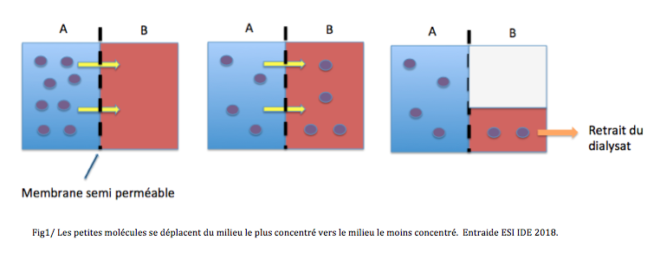 Dialyse péritonéale - ENTRAIDE ESI IDE